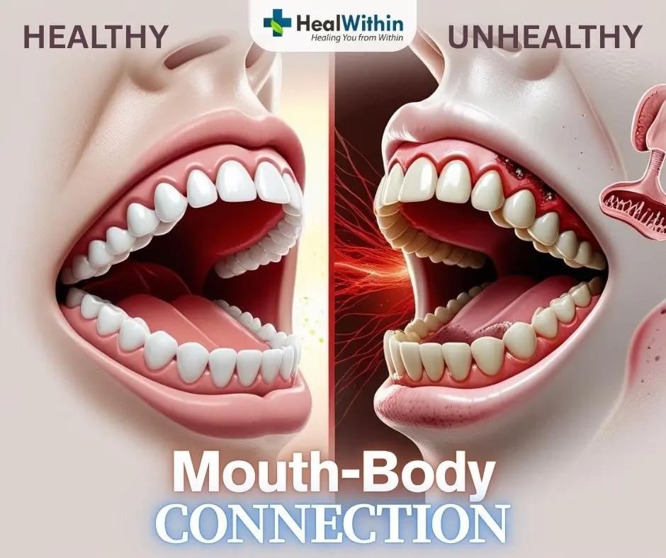 How Dental Health Triggers Chronic Diseases | Heal Within