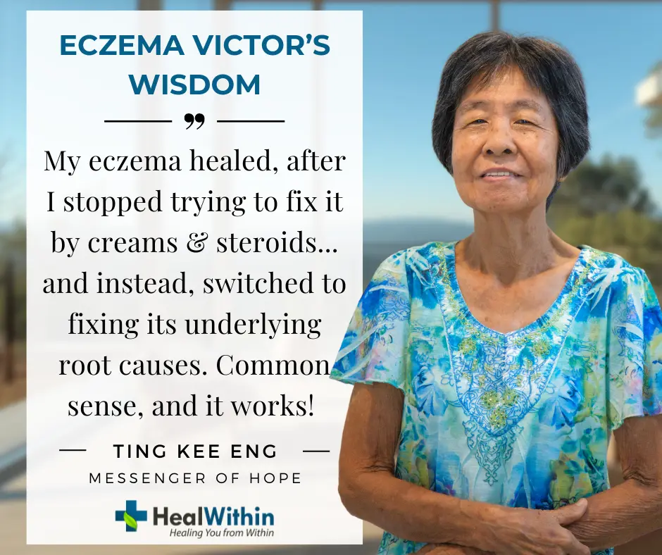 Stubborn Eczema - How I Finally Healed It at 85 | Heal Within®